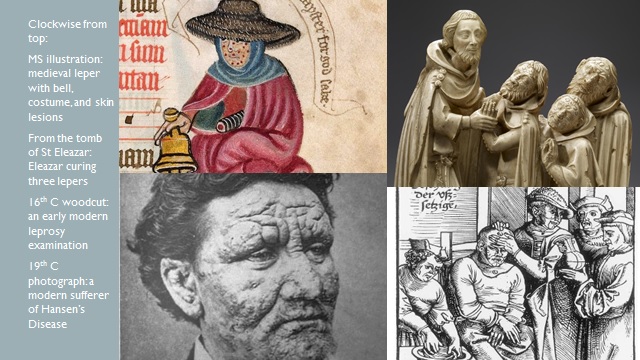 Sacred Stigma: Intimate Interactions with the Leprous Body in Late ...